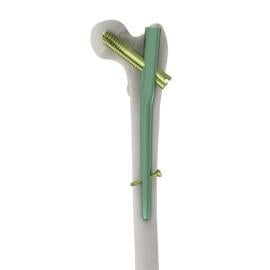 Meril™ PFIN - Advanced Proximal Femur Integrated Nail for Hip Fracture ...
