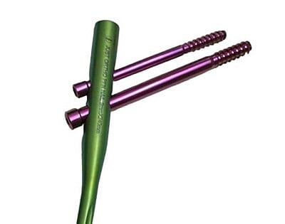 Proximal Femoral Nail System: Stabilizing Femur Fractures with PFN & PFNA